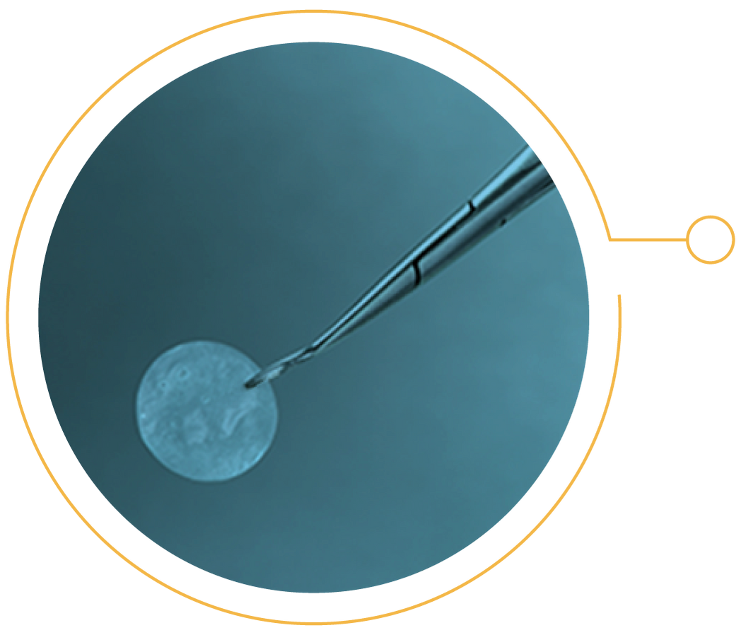 About | RevoShield- Amniotic Discs